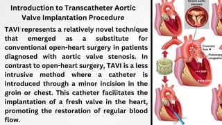 Essential Facts to Understand Before Undergoing a Transcatheter Aortic ...
