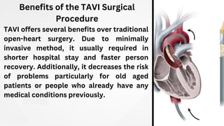 Essential Facts to Understand Before Undergoing a Transcatheter Aortic ...
