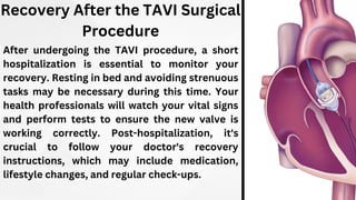 Essential Facts to Understand Before Undergoing a Transcatheter Aortic ...
