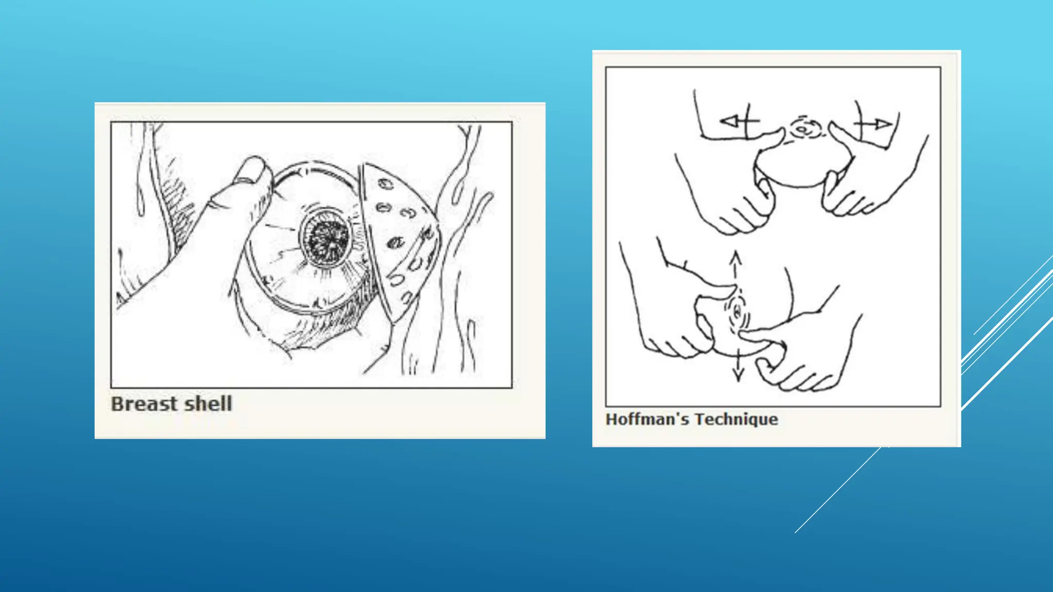 Essential Intrapartum and Newborn Care (EINC).pptx