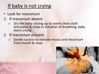 Essential newborn care | PPTX