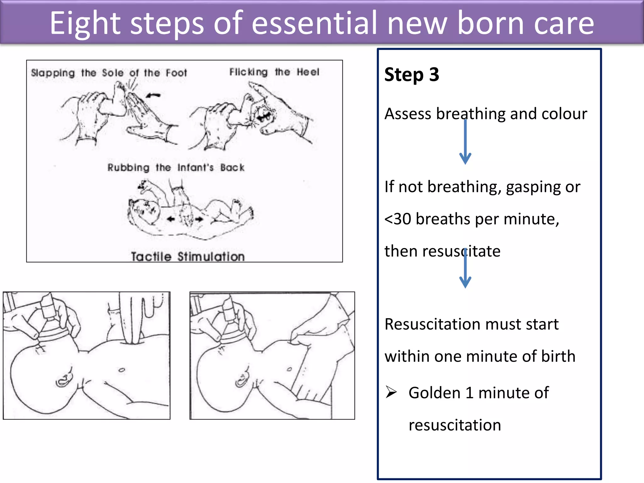 Essential Newborn Care | PPTX