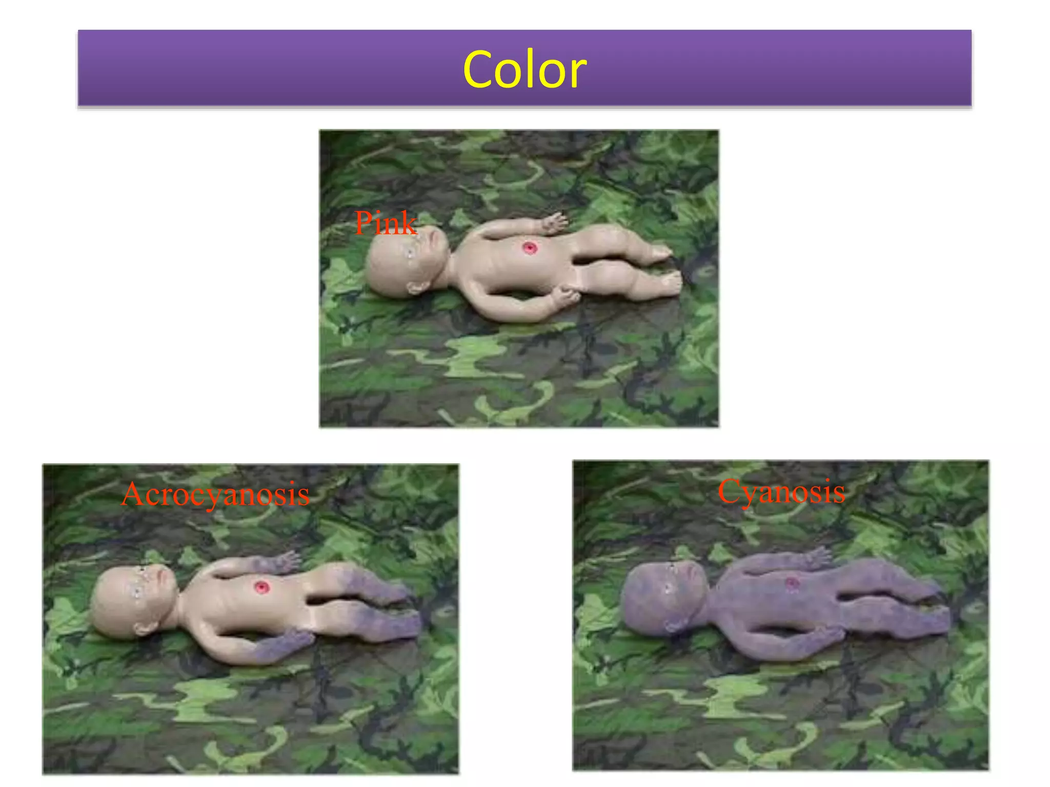 Essential Newborn Care | PPTX