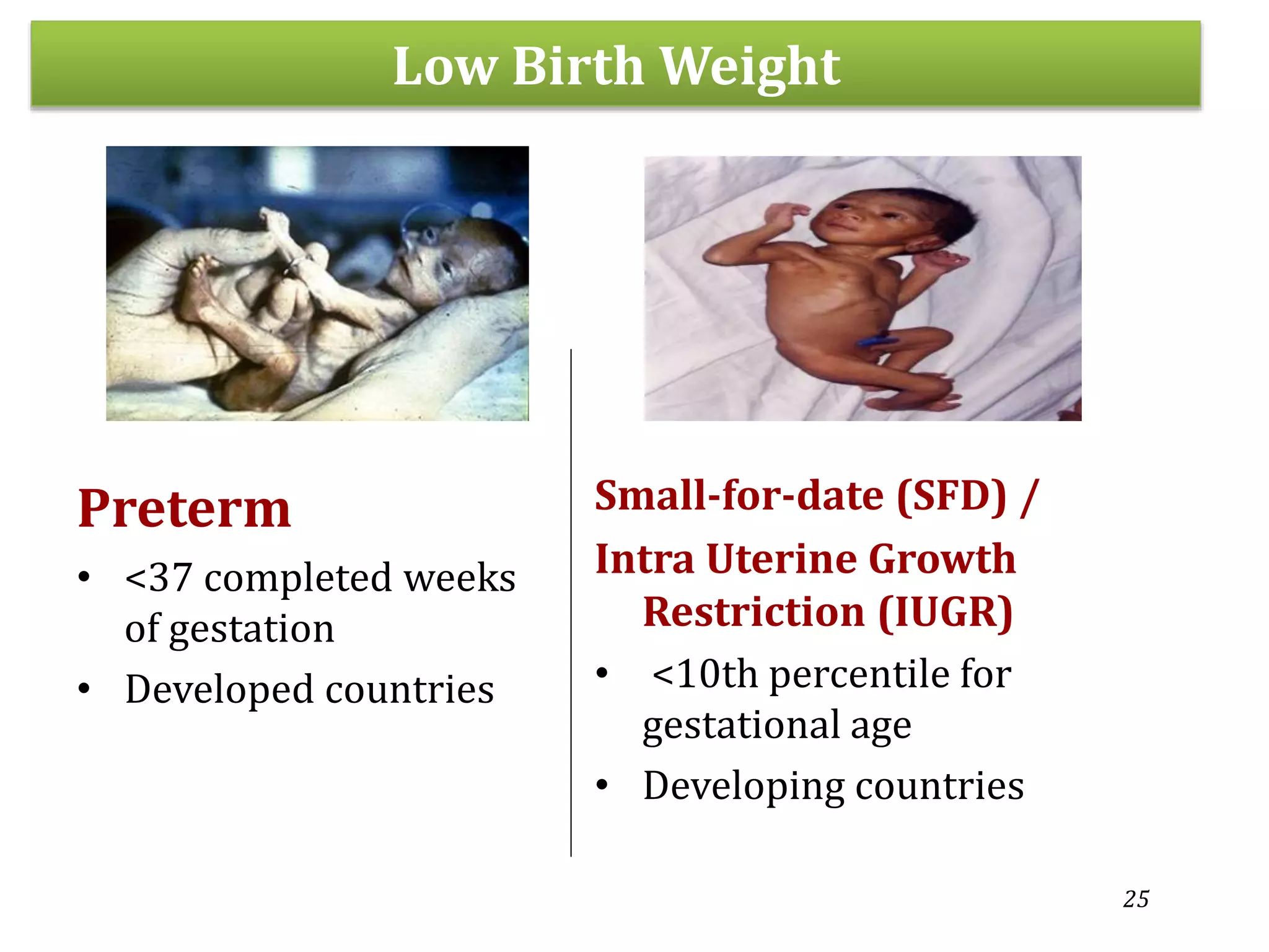 Essential Newborn Care | PPTX