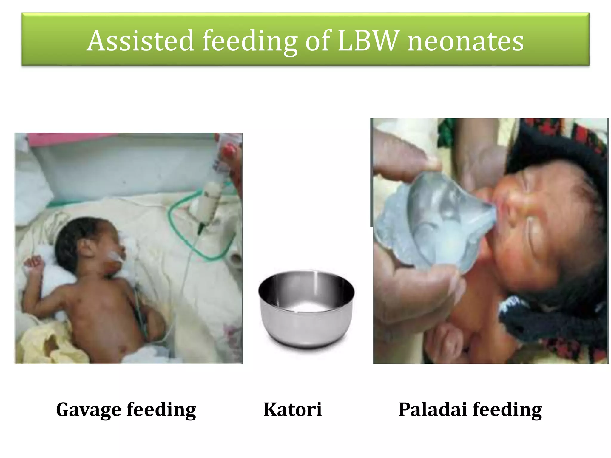 Essential Newborn Care | PPTX
