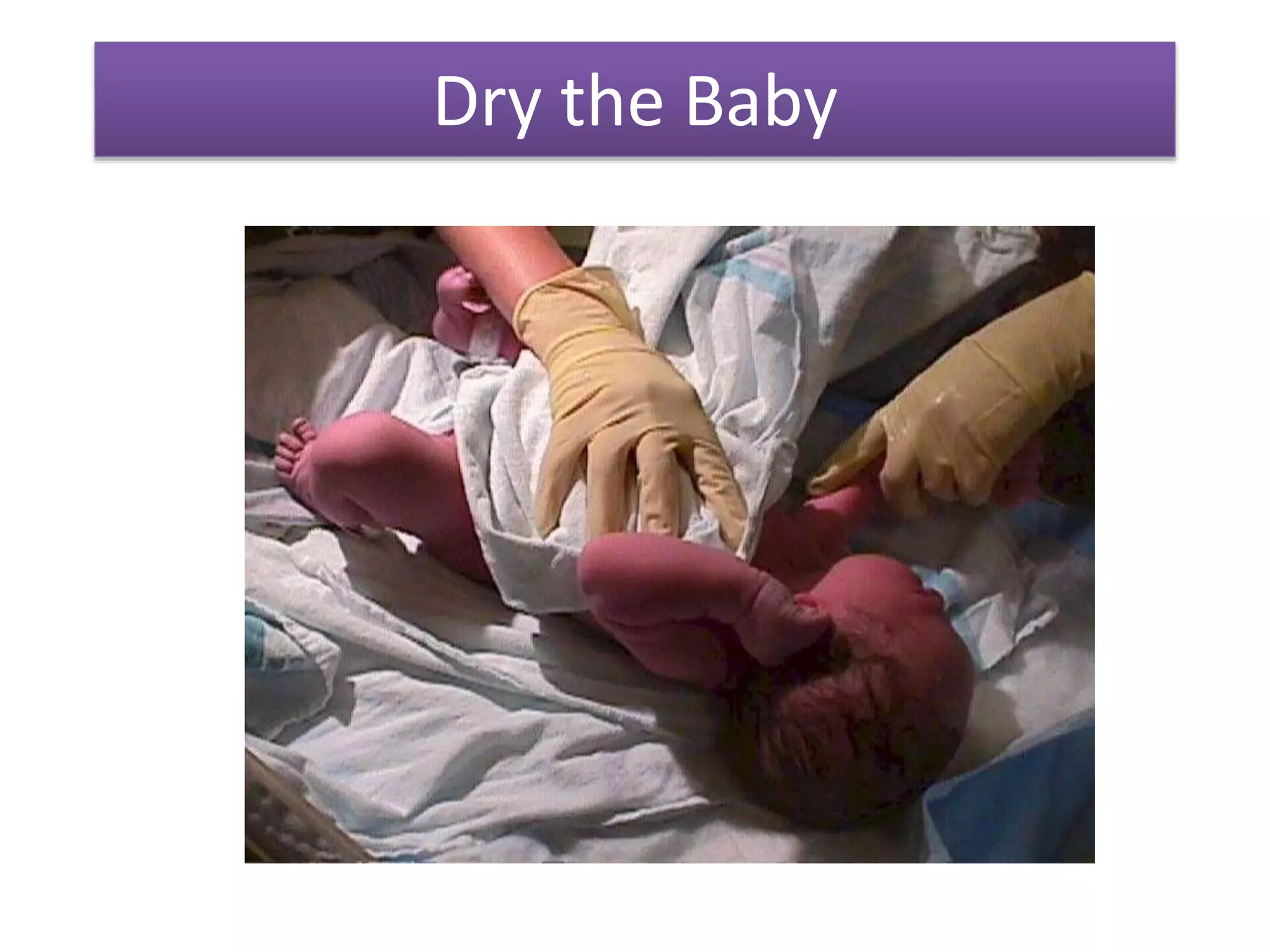 Essential Newborn Care | PPTX