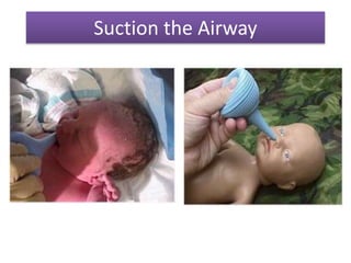 Essential Newborn Care | PPTX