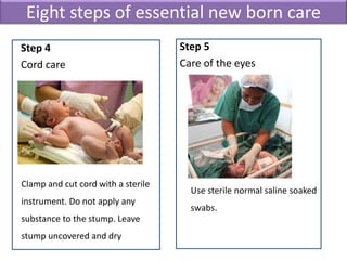 Essential Newborn Care | PPTX