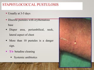 Essential new born care latest | PPT