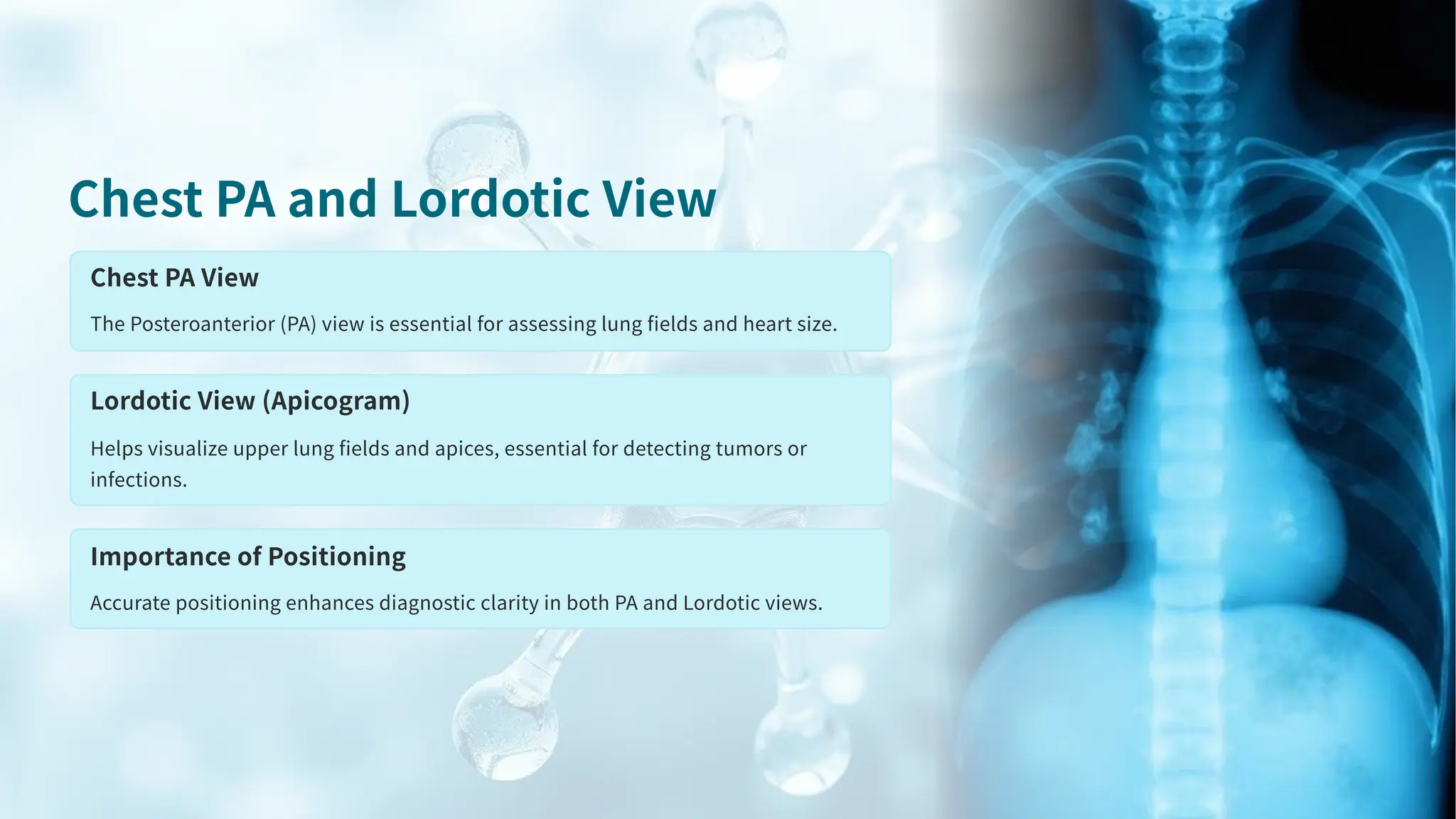 Essential Radiographic Views of chest....pdf