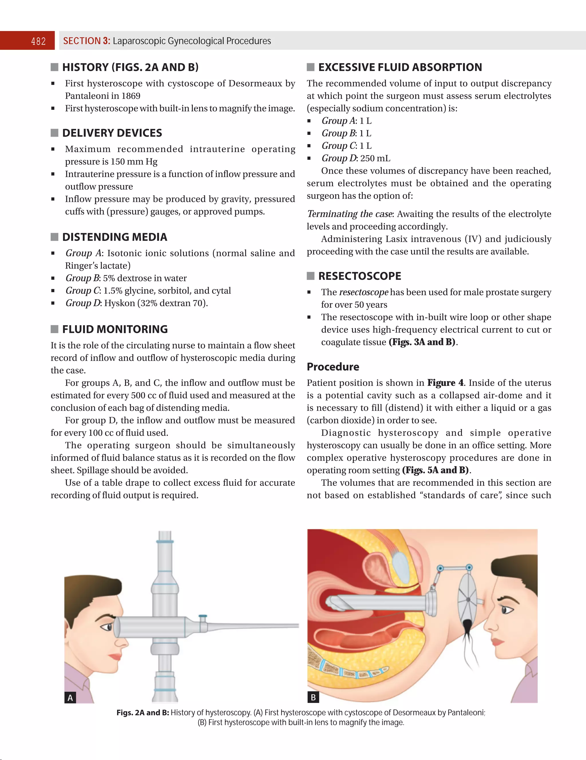 Essentials of Hysteroscopy | PDF