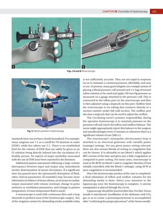 Essentials of Hysteroscopy | PDF