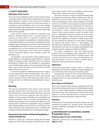 Essentials of Hysteroscopy | PDF