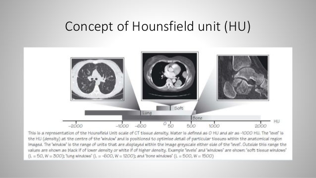 Essentials of CT brain (For Undergraduates)