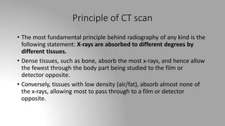 ESSENTIALS_OF_CT_BRAIN_For_Undergraduate.pptx