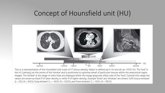 ESSENTIALS_OF_CT_BRAIN_For_Undergraduate.pptx