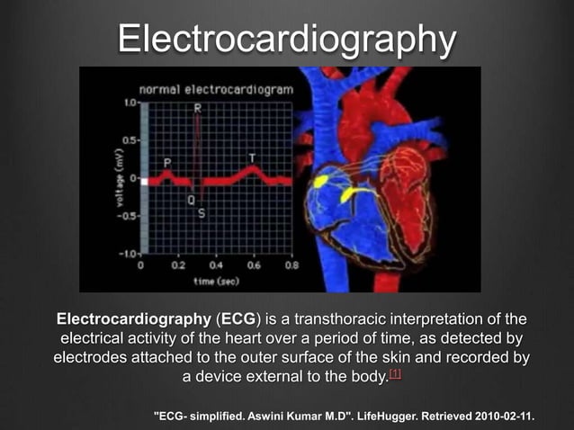 Essentials of ecg interpretation aphrs