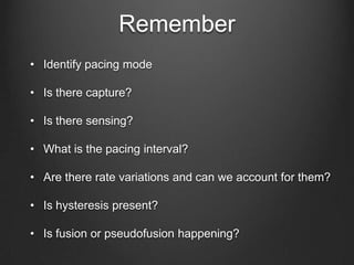 Essentials of ecg interpretation aphrs | PPT