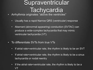 Essentials of ecg interpretation aphrs | PPT