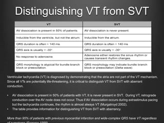 Essentials of ecg interpretation aphrs | PPT