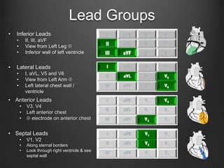 Essentials of ecg interpretation aphrs | PPT