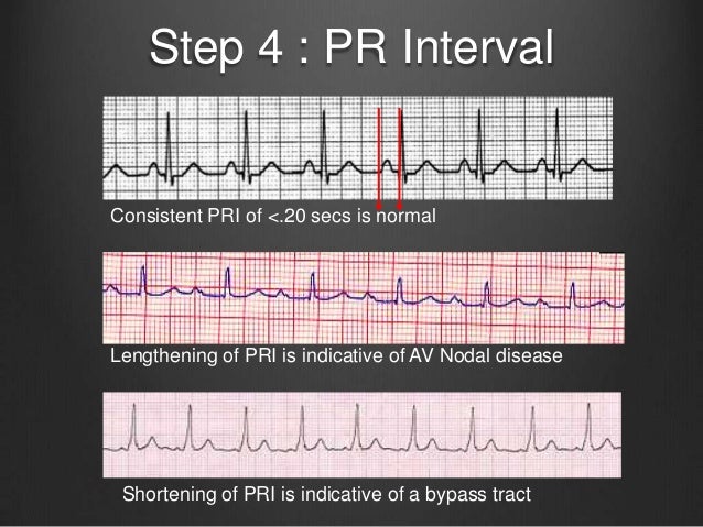 Essentials of ecg interpretation aphrs