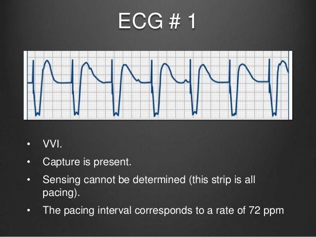 Essentials of ecg interpretation aphrs