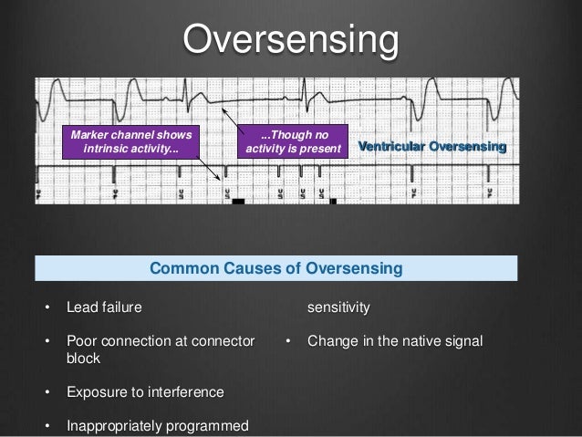 Essentials of ecg interpretation aphrs
