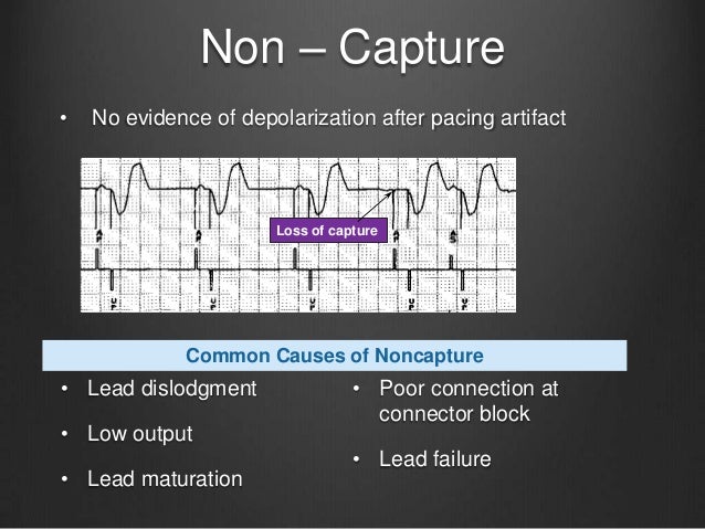 Essentials of ecg interpretation aphrs