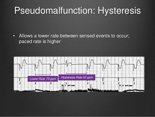 Essentials of ecg interpretation aphrs
