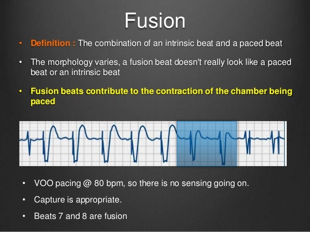 Essentials of ecg interpretation aphrs