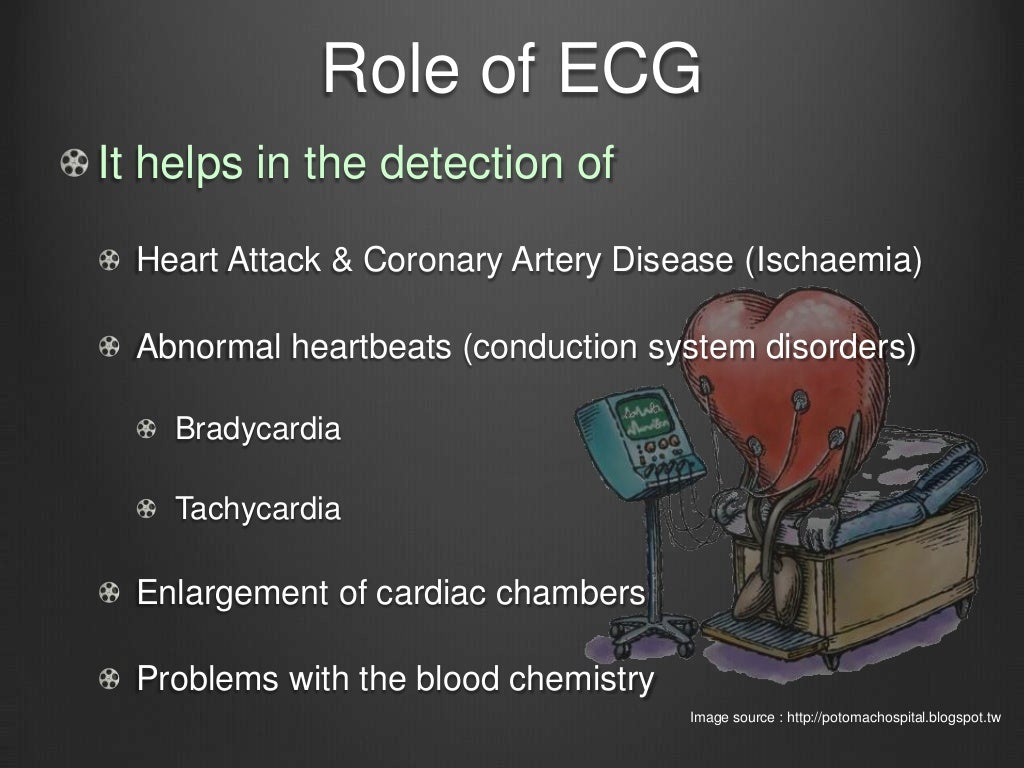 Essentials of ecg interpretation aphrs
