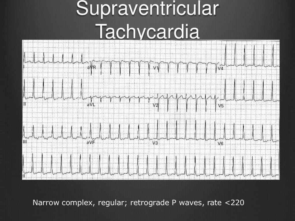 Essentials of ecg interpretation aphrs