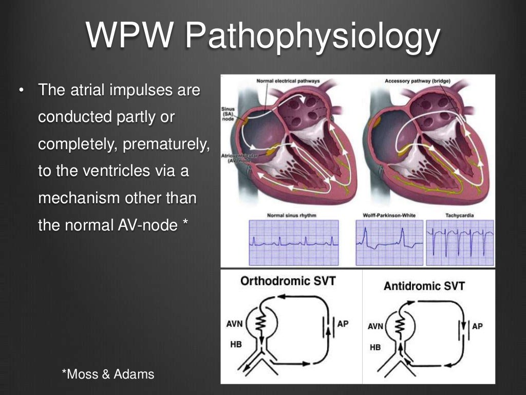 Essentials of ecg interpretation aphrs