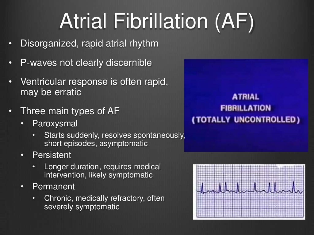 Essentials of ecg interpretation aphrs