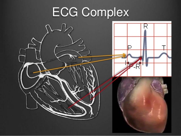 Essentials of ecg interpretation aphrs