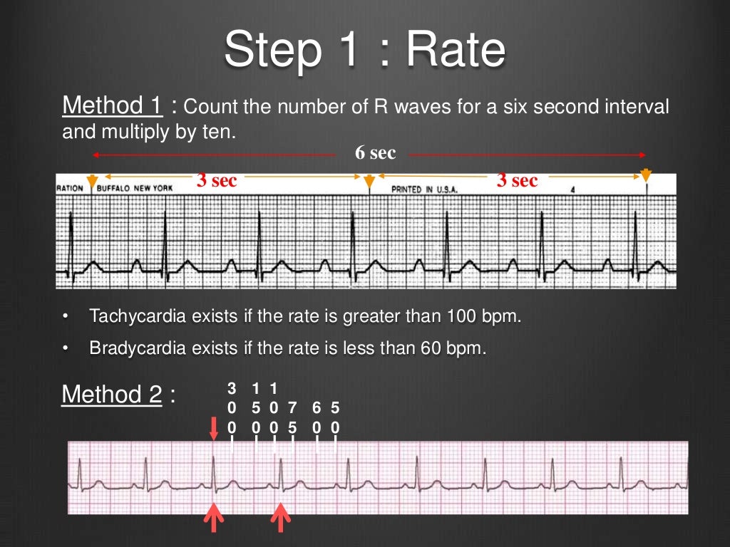 Essentials of ecg interpretation aphrs