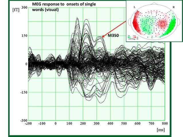 Essentials of EEG/MEG | PPTX | Brain and Nervous System Disorders ...