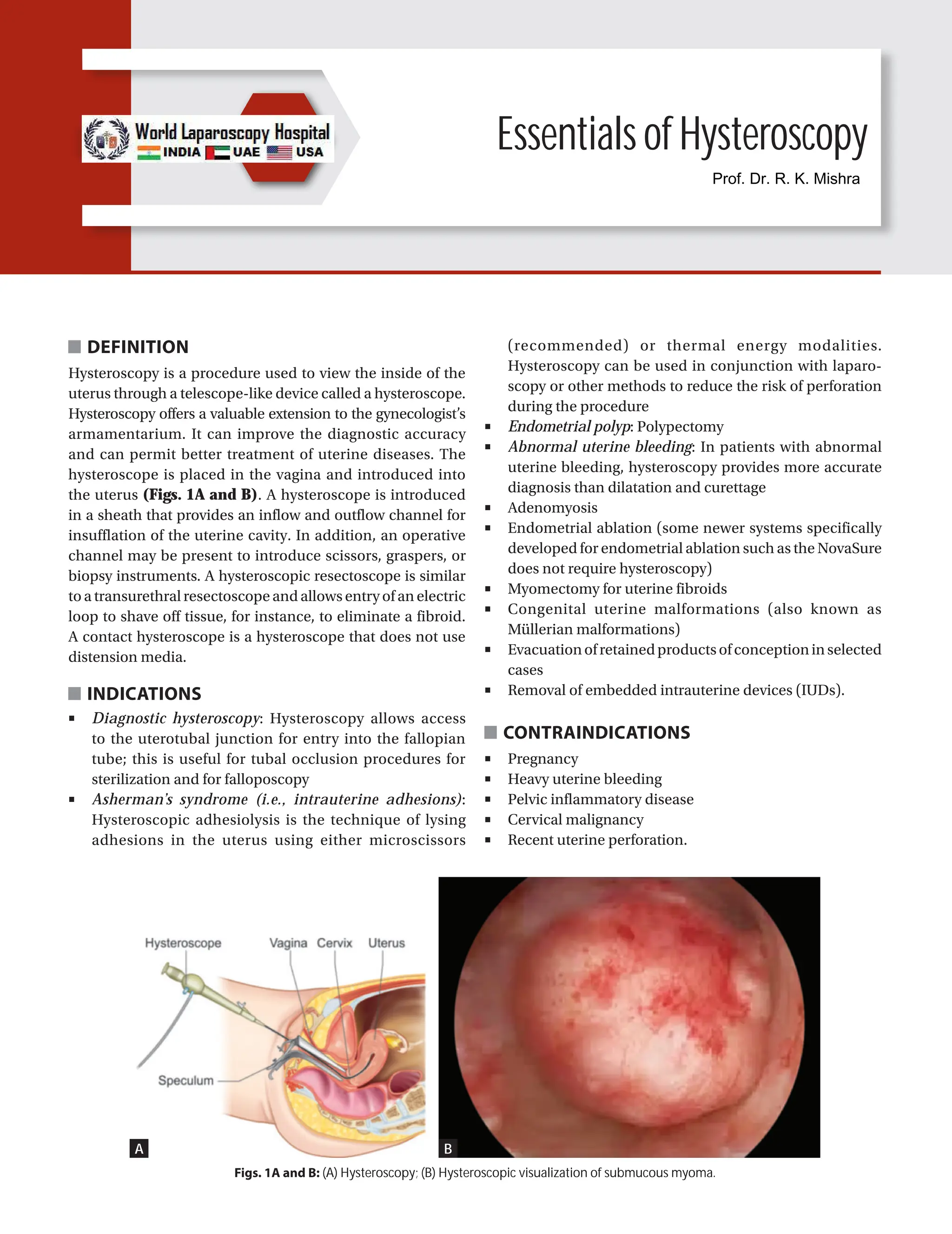 Essentials of Hysteroscopy in Laparoscopic Surgery.pdf
