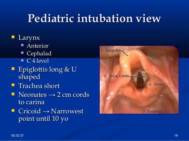 Essentials of pediatric trauma care short september 2012
