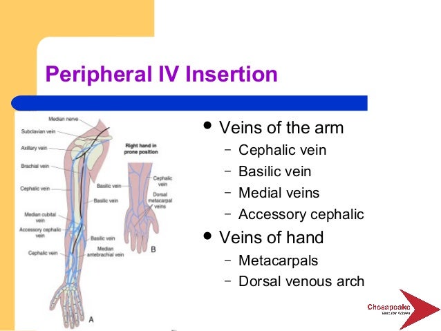 Essentials of vascular access