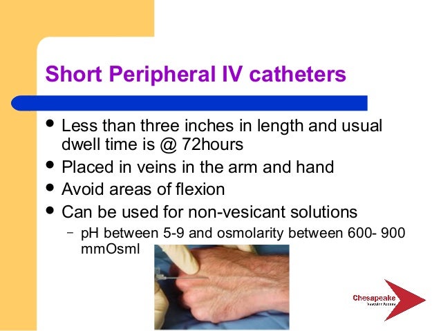 Essentials of vascular access