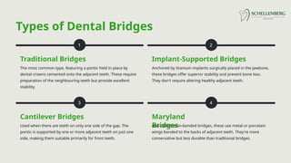 Essential Things to Know Before Choosing a Dental Bridge Option | PPTX