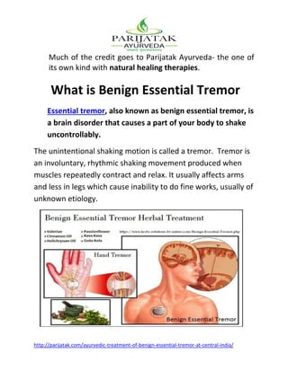 Benign Essential Tremor | PDF