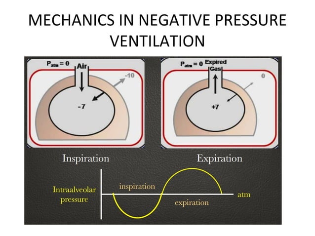 Essential ventilation | PPT | Lung and Respiratory Health | Diseases ...