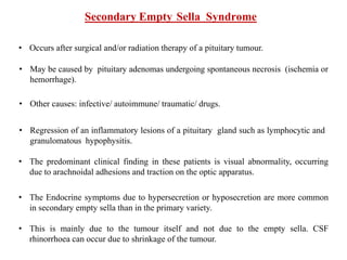 Empty sella syndrome | PPTX