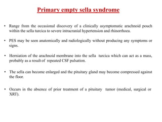 Empty sella syndrome | PPTX