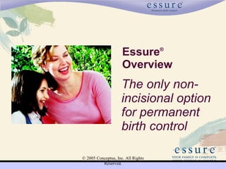 Essure | PPT