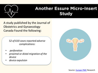 Essure Insert Complications: See The Data Prompting Lawsuit ...