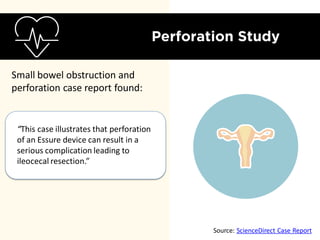 Essure Insert Complications: See The Data Prompting Lawsuit Investigations | PPT
